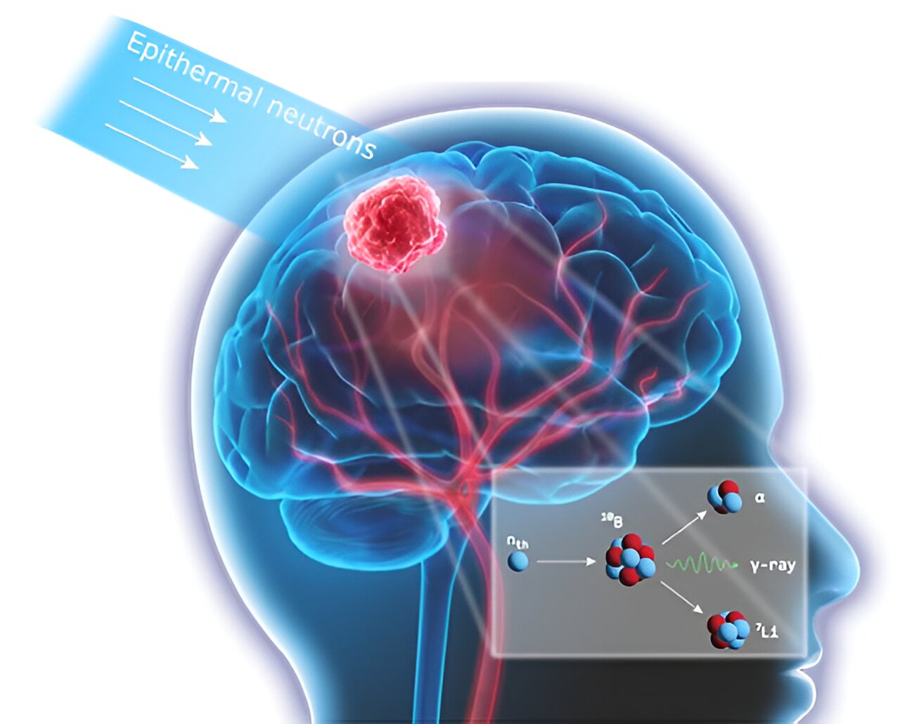 Gallium-68 từ Cyclotron phục vụ chẩn đoán ung thư - Ae-radioactive